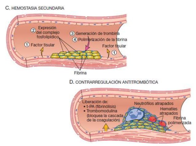 Patologia 5 a hiperemia y congestión | PPT