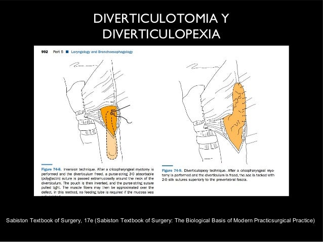 Patologia benigna esofago 1