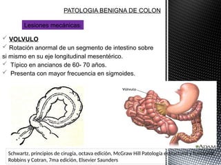 PATOLOGIA BENIGNA Y MALIGNA DE COLON,RECTO Y ANO.pptx