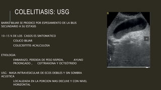 PATOLOGIA BILIAR, colelitiasis, colangitis | PPTX