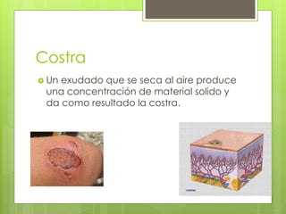 Lesiones patologicas | PPTX