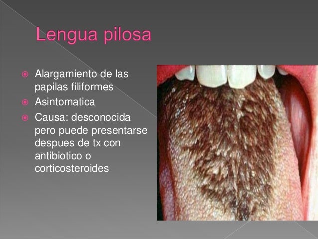 Patologia Bucal Resumen