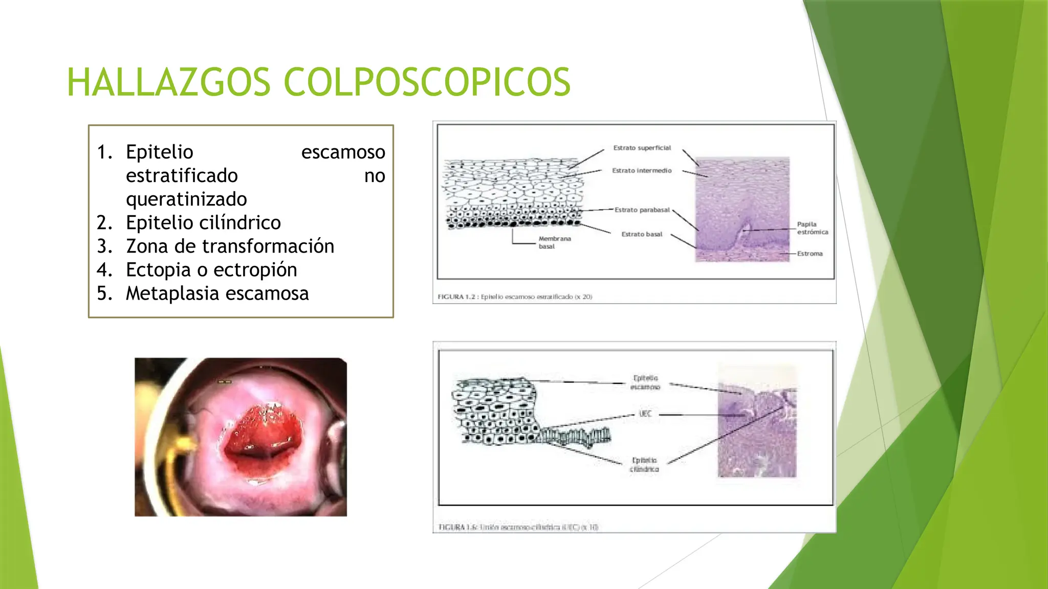 PATOLOGIA CERVICAL, DEFINICION CLASIFICACION | PPTX