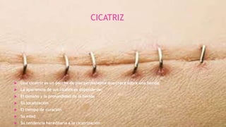 Patologia cicatriz | PPTX
