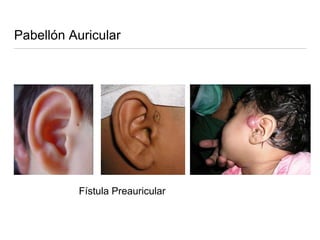 Patologia Congenita en ORL | PPTX