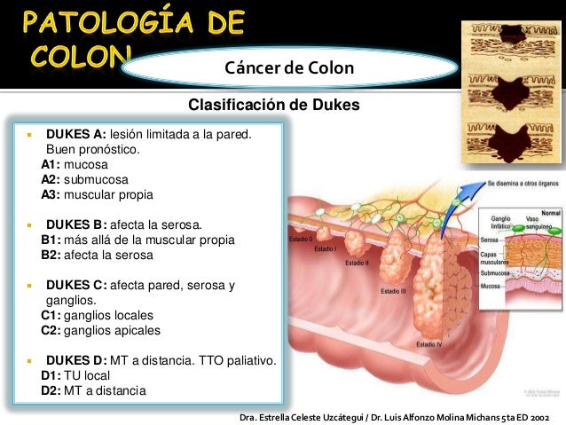 Patologia de colon.! keyber