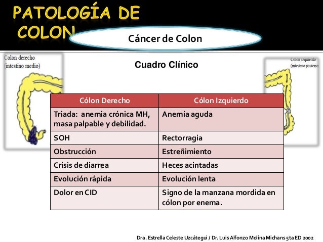 Patologia de colon.! keyber