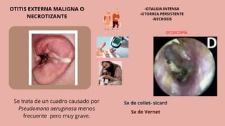 PAtología otitis externa medias interna | PDF