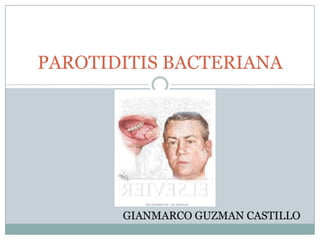 Patologia de la boca y glandulas salivales (Gianmarco Guzman Castillo ...