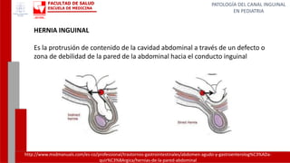 Patologia del canal inguinal | PPTX