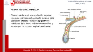 Patologia del canal inguinal | PPTX