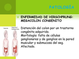 Patologia Del Colon | PPTX