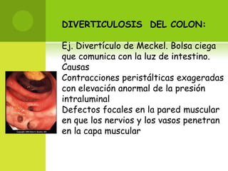 Patologia Del Colon | PPTX
