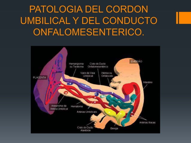 Patologia del cordon y persistencia del uraco