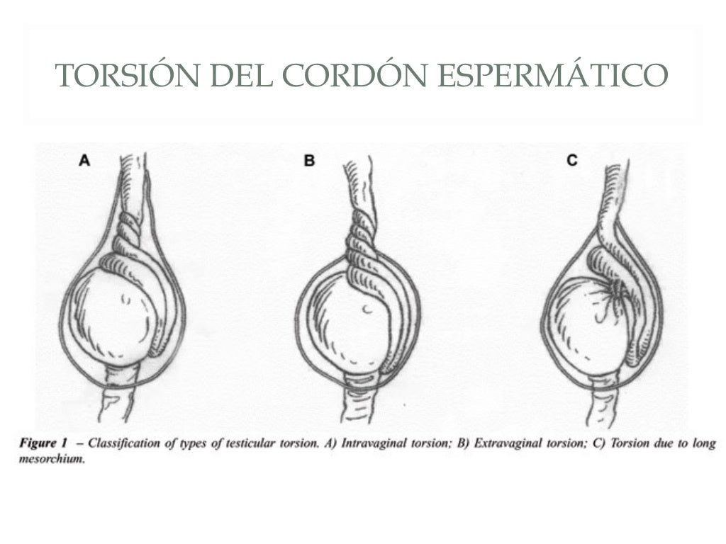 Enfermedades En El Escroto Imagen