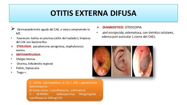 Patologia del oido