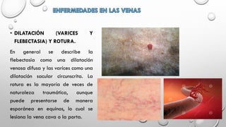 Patología del sistema circulatorio | PDF