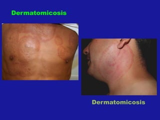 Patología dermatológica en Atención Primaria. Visión del dermatólogo | PDF