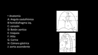 Patologia de torax radiologica | PPTX