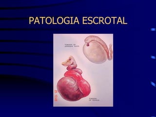 Patologia Escrotal | PPT