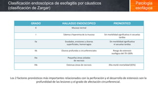 Patologia esofagica | PPT