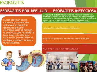 Patologia esofago | PPTX