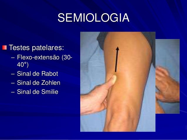 Patologia femuropatelar