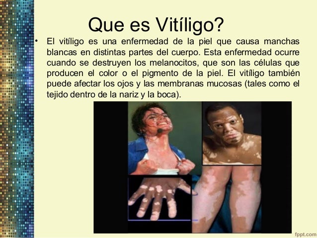 gangrena de fournier