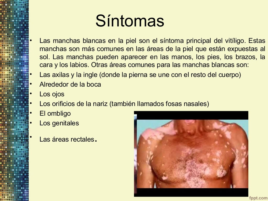 gangrena de fournier