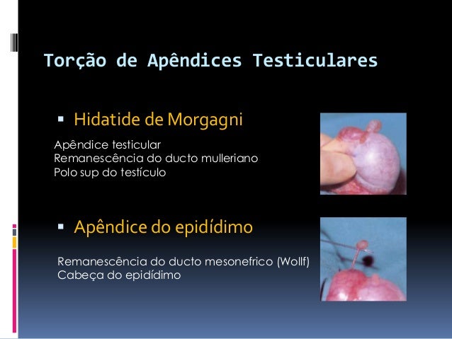 Patologia genital masculina benigna