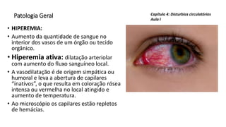 Patologia geral - distúrbios da circulação - capítulo 4 aula 1 | PPTX
