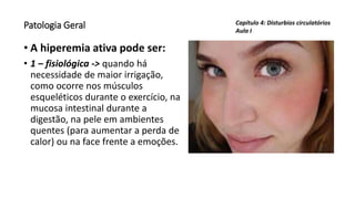 Patologia geral - distúrbios da circulação - capítulo 4 aula 1 | PPTX