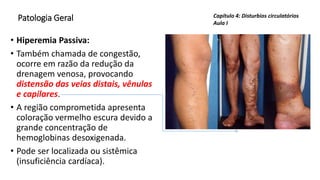 Patologia geral - distúrbios da circulação - capítulo 4 aula 1 | PPTX