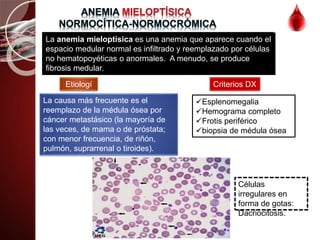 Patologia hemopoyetica | PPTX