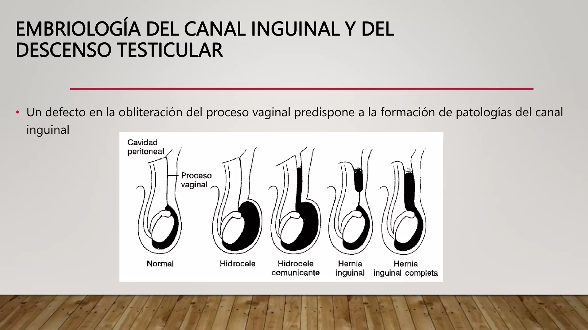 Patología inguinal.pptx
