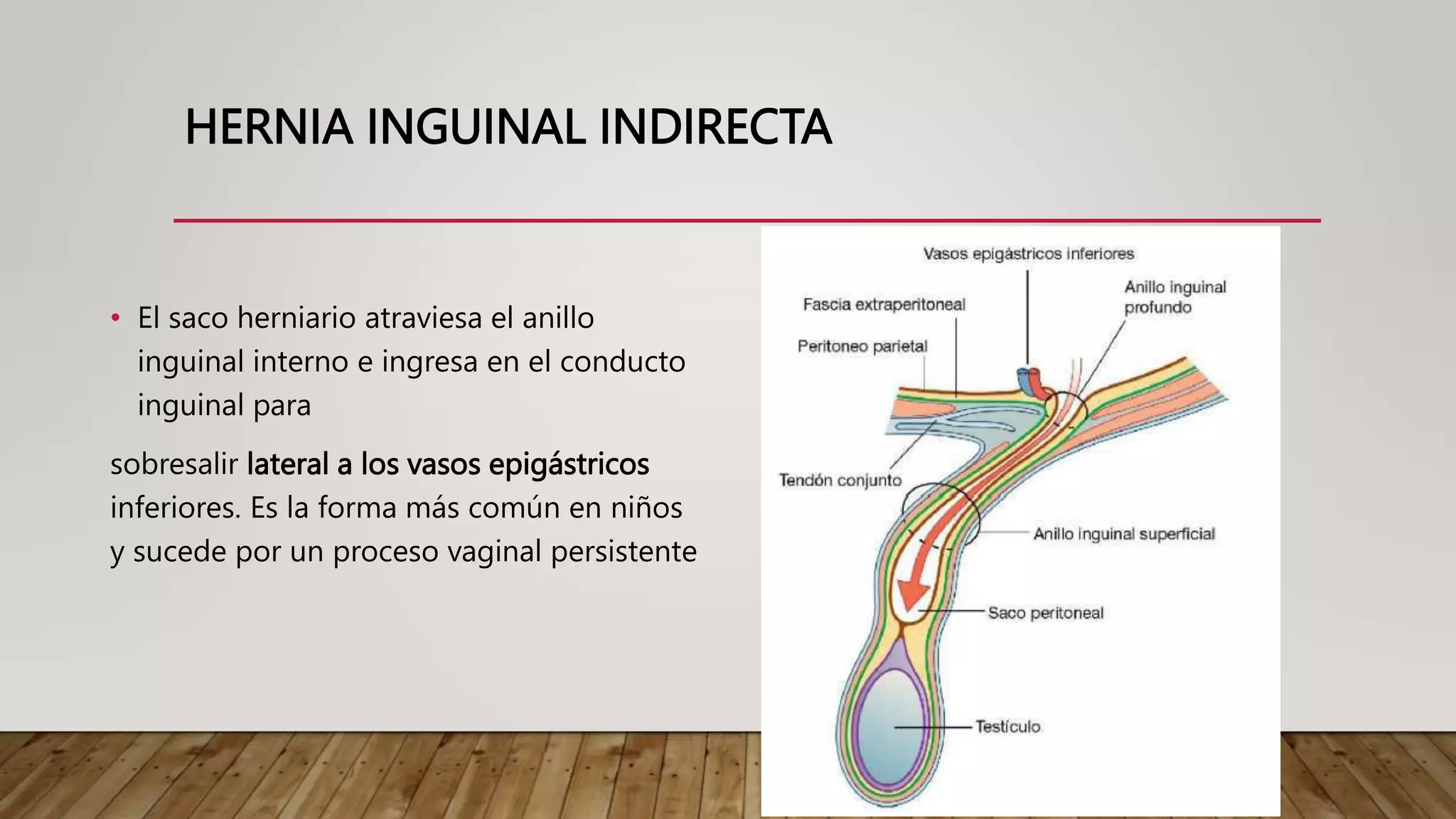 Patología inguinal.pptx