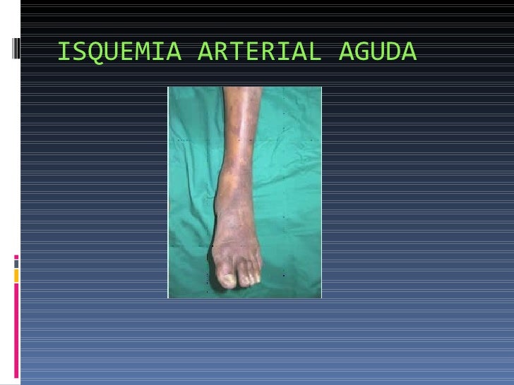Patologia no traumatica de extremidades inferiores