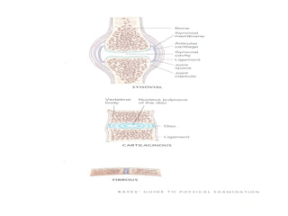 Patologia osteoarticular | PPT