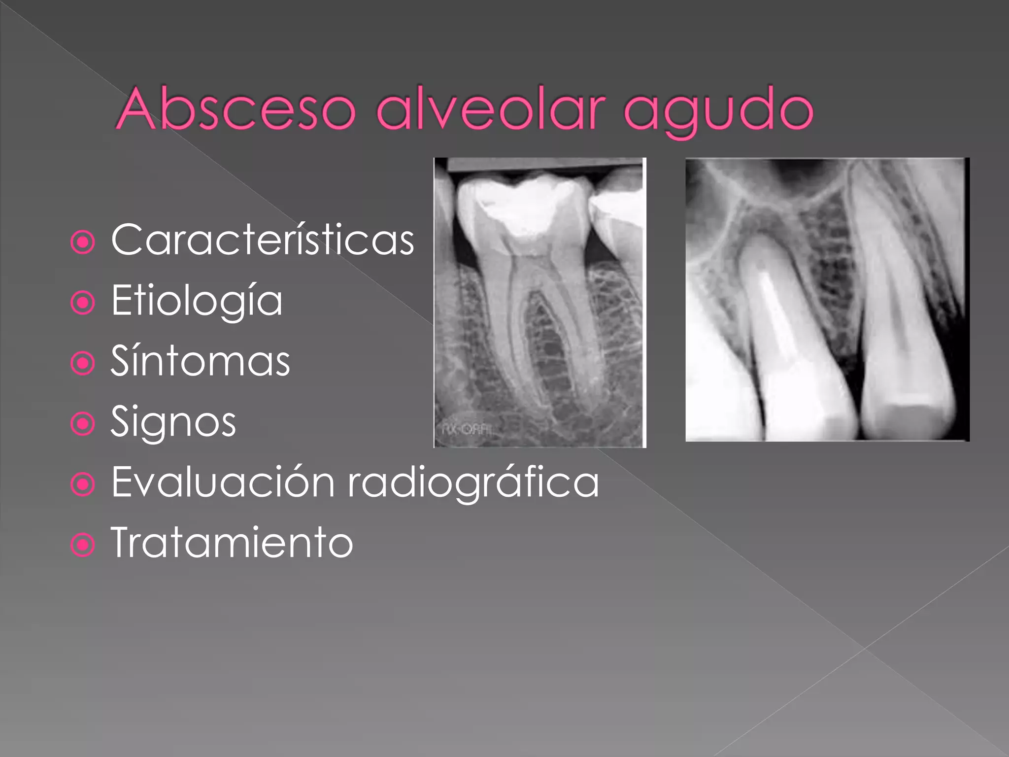 Patologia pulpar y periapical UAQ | PPT