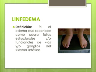 Patologia quirurgica del sistema linfatico | PPTX