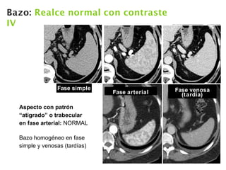 PATOLOGIA QUIRURGICA PANCREAS Y BAZO.pptx