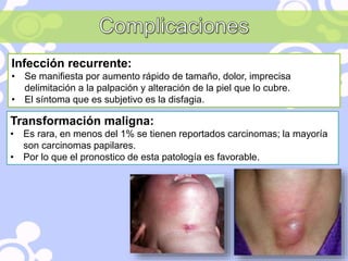 Patología Quirurgica de Cuello en pediatria | PPTX