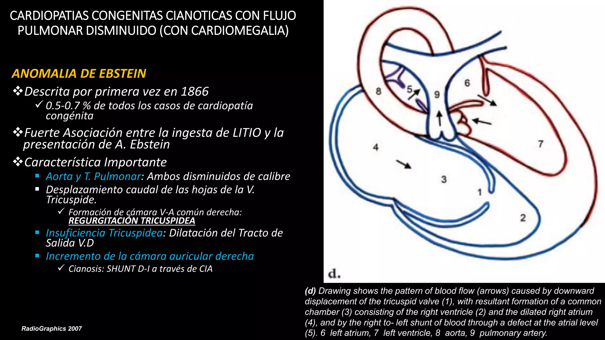 Patologia rx tc rmn cardiopatias congenitas 2018 | PDF