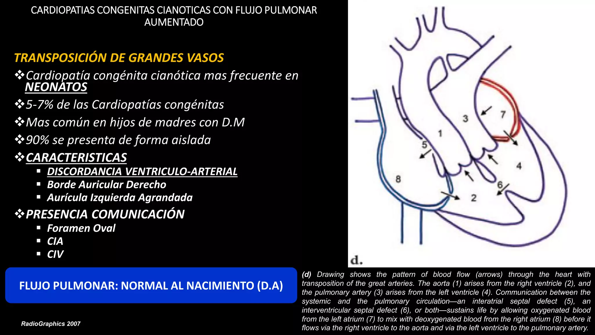 Patologia rx tc rmn cardiopatias congenitas 2018 | PDF