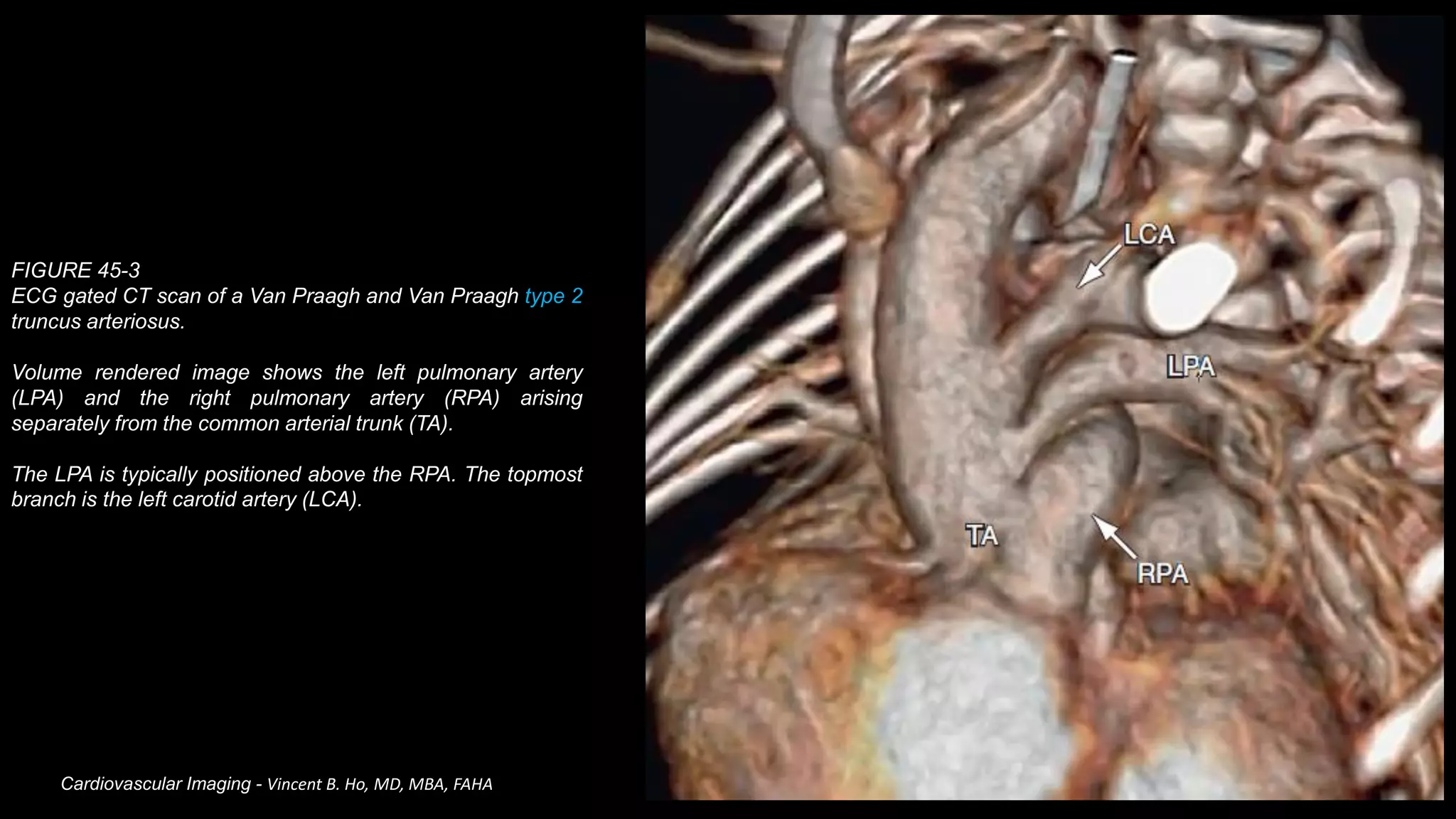 Patologia rx tc rmn cardiopatias congenitas 2018 | PDF