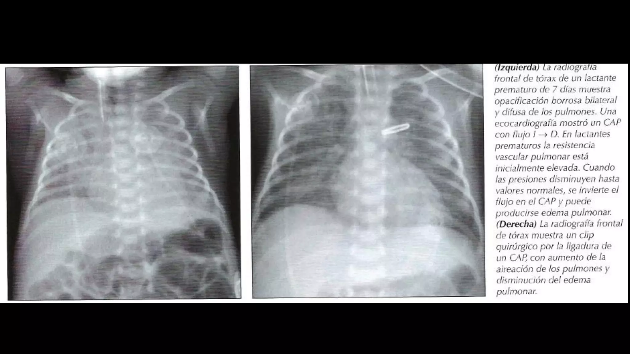 Patologia rx tc rmn cardiopatias congenitas 2018 | PDF