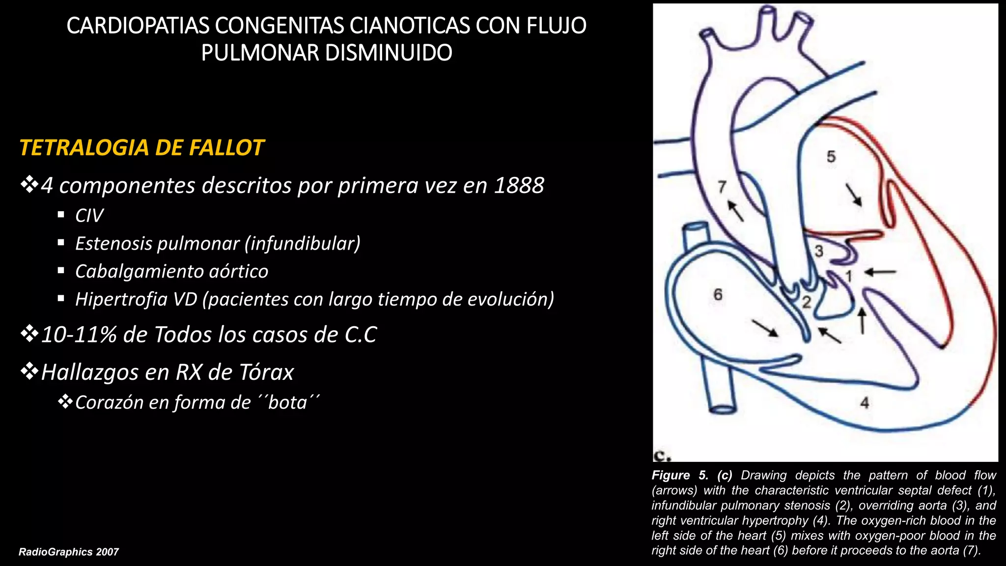 Patologia rx tc rmn cardiopatias congenitas 2018 | PDF