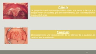 Patologias | PPTX