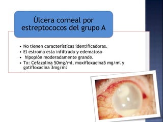 ulceras corneales bacterianas | PPTX