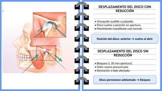 Patologias de la Articulacion Temporo Mandibular | PPTX